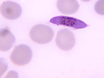 New Study Answers Key Public Health Question in Battle Against Malaria | UMD Department of Cell ...